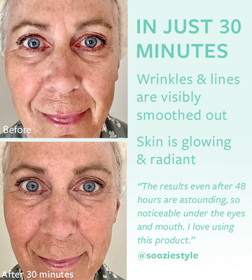 48 Hour Wrinkle Freeze | Freezeframe – freezeframe