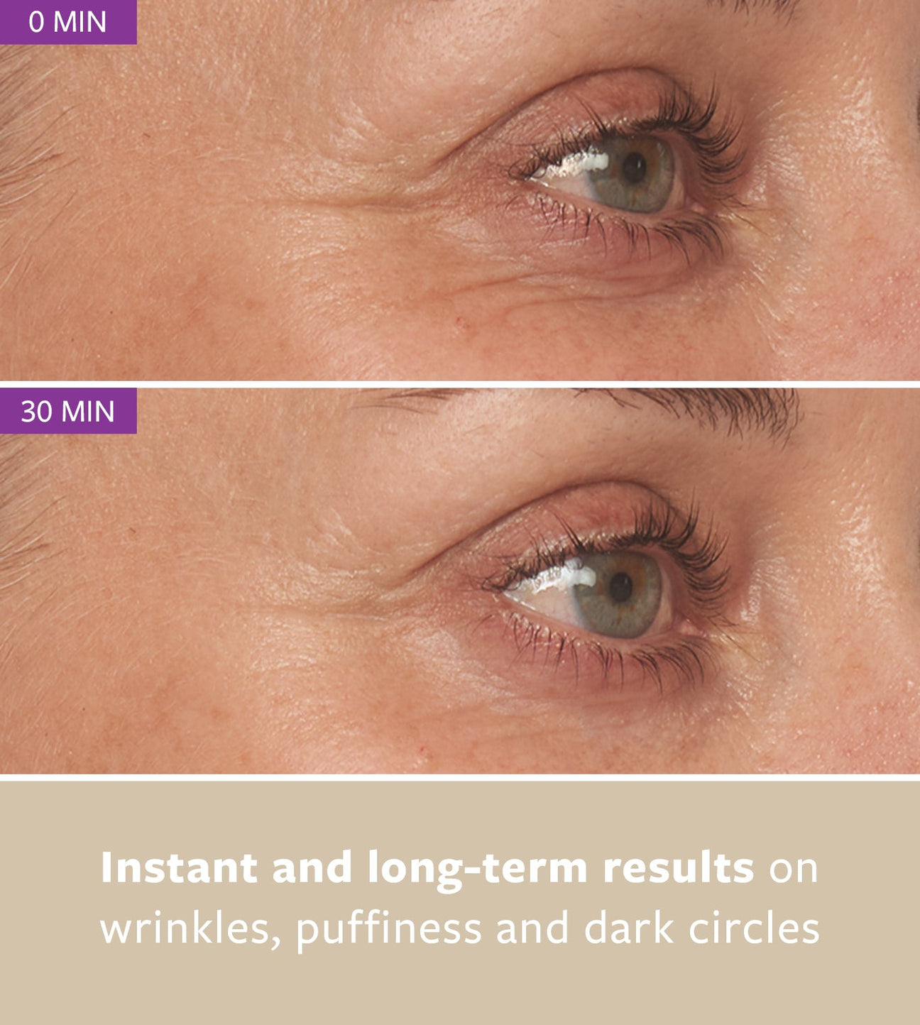 REVITALEYES 15ml - Freeze Frame – Freezeframe